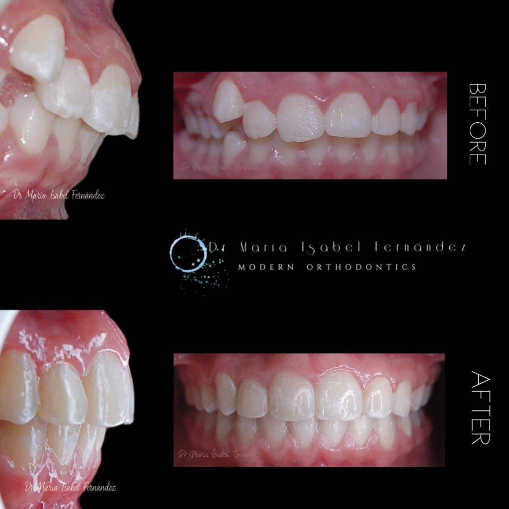 The benefits of having a healthy bite - Smile Studios - Best Medical ...